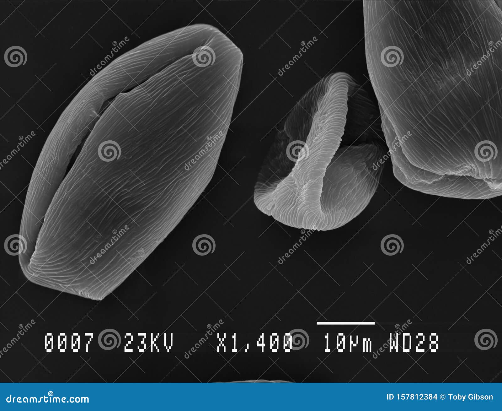 Three Cherry Tree Pollen Grains Stock Photo - Image of close, scanning ...