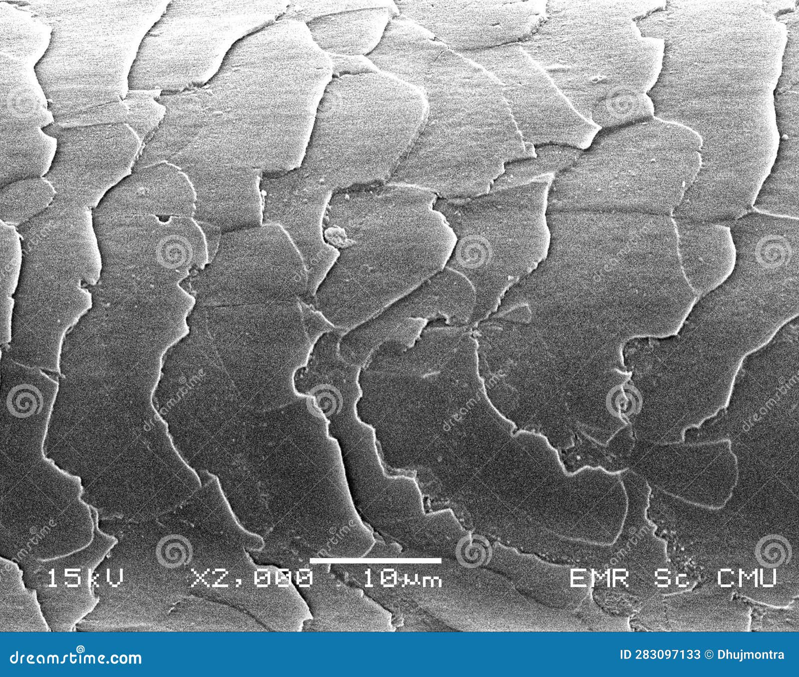 Human Hair Under Electron Microscope