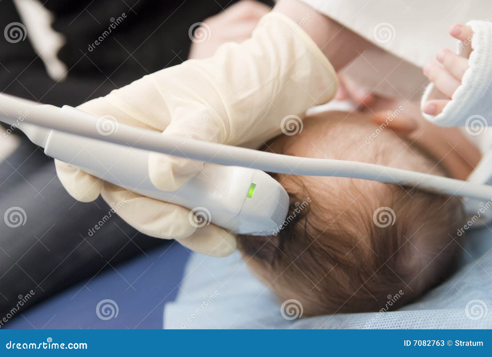 Scanning of a Head of the Child Stock Image - Image of children ...