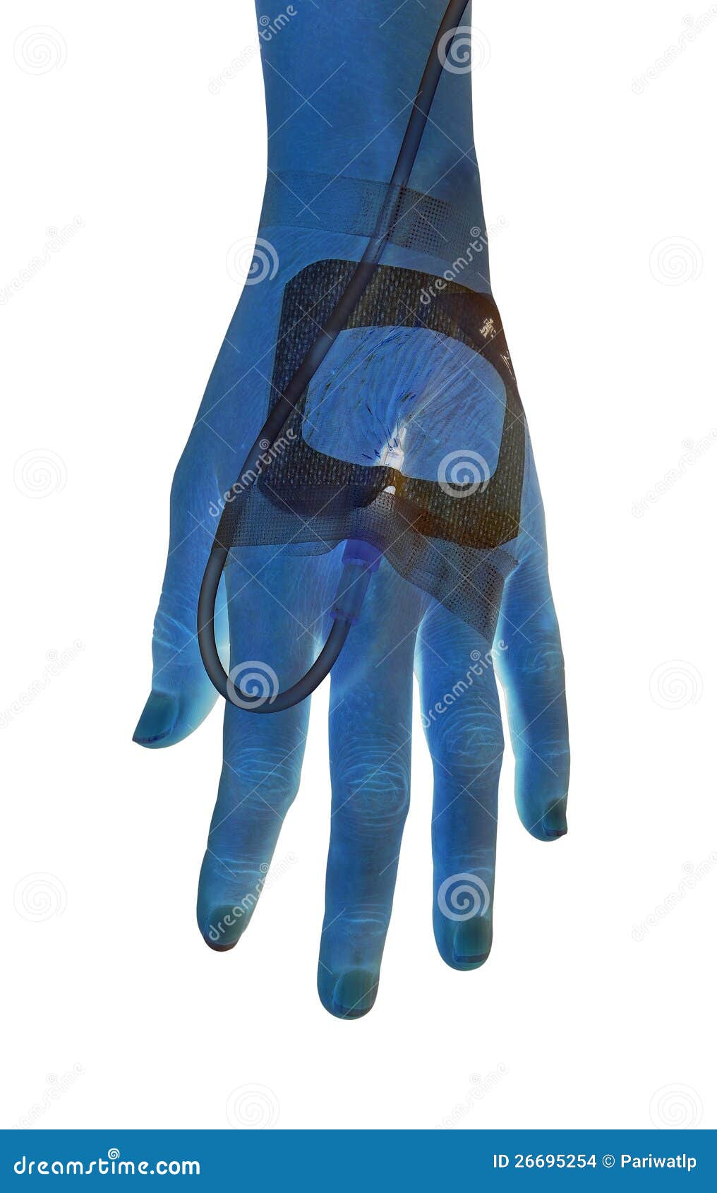 Scanning of patients hand stock photo. Image of cure - 26695254