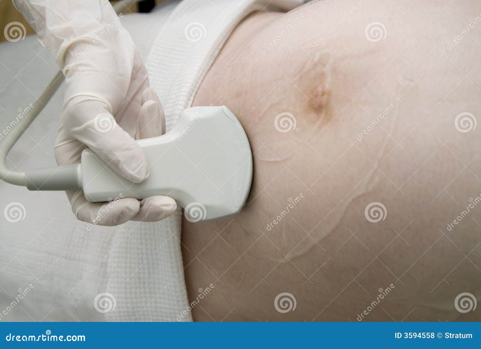Scanning of a stomach stock photo. Image of mother, pregnant - 3594558