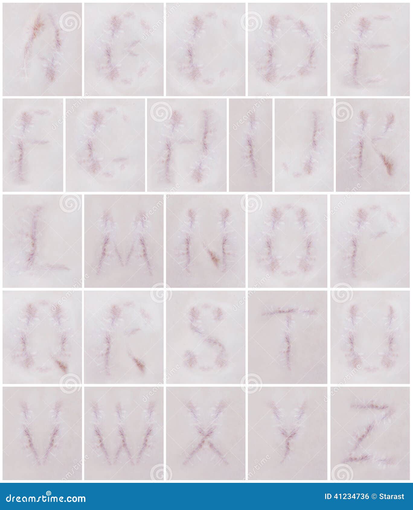 Scar Alphabet on Human Skin Stock Photo - Image of ugliness, human ...