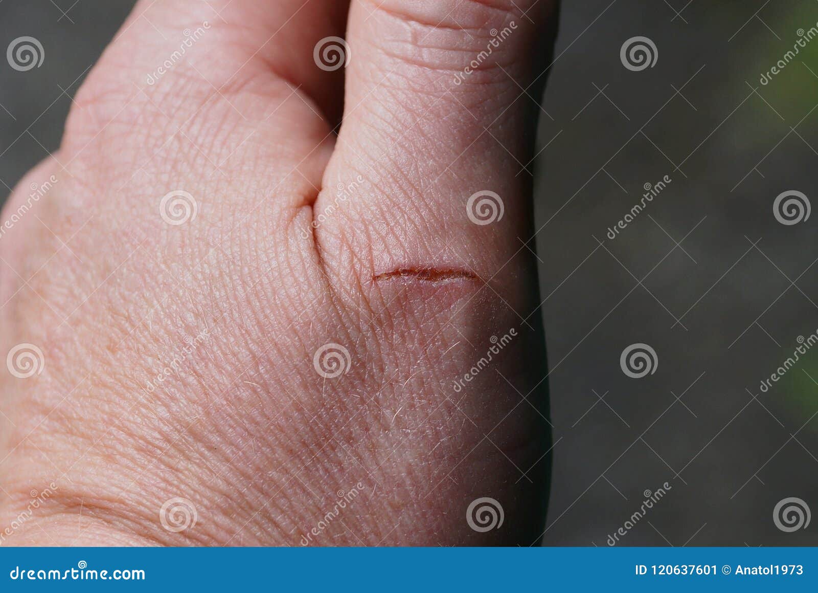 A Cut on the Finger of a Man Stock Image - Image of human, finger ...