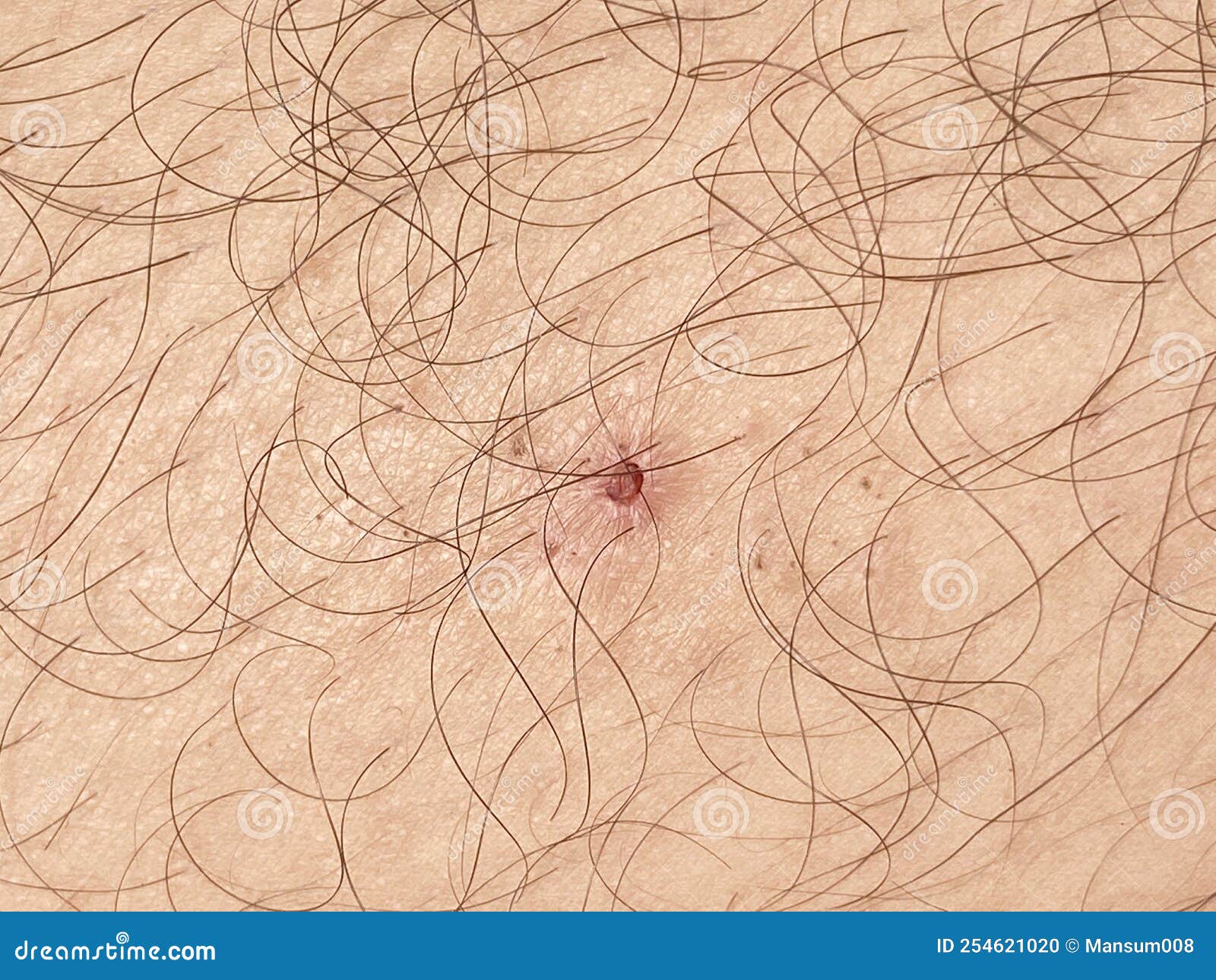 Scar on human body stock photo. Image of closeup, head - 254621020
