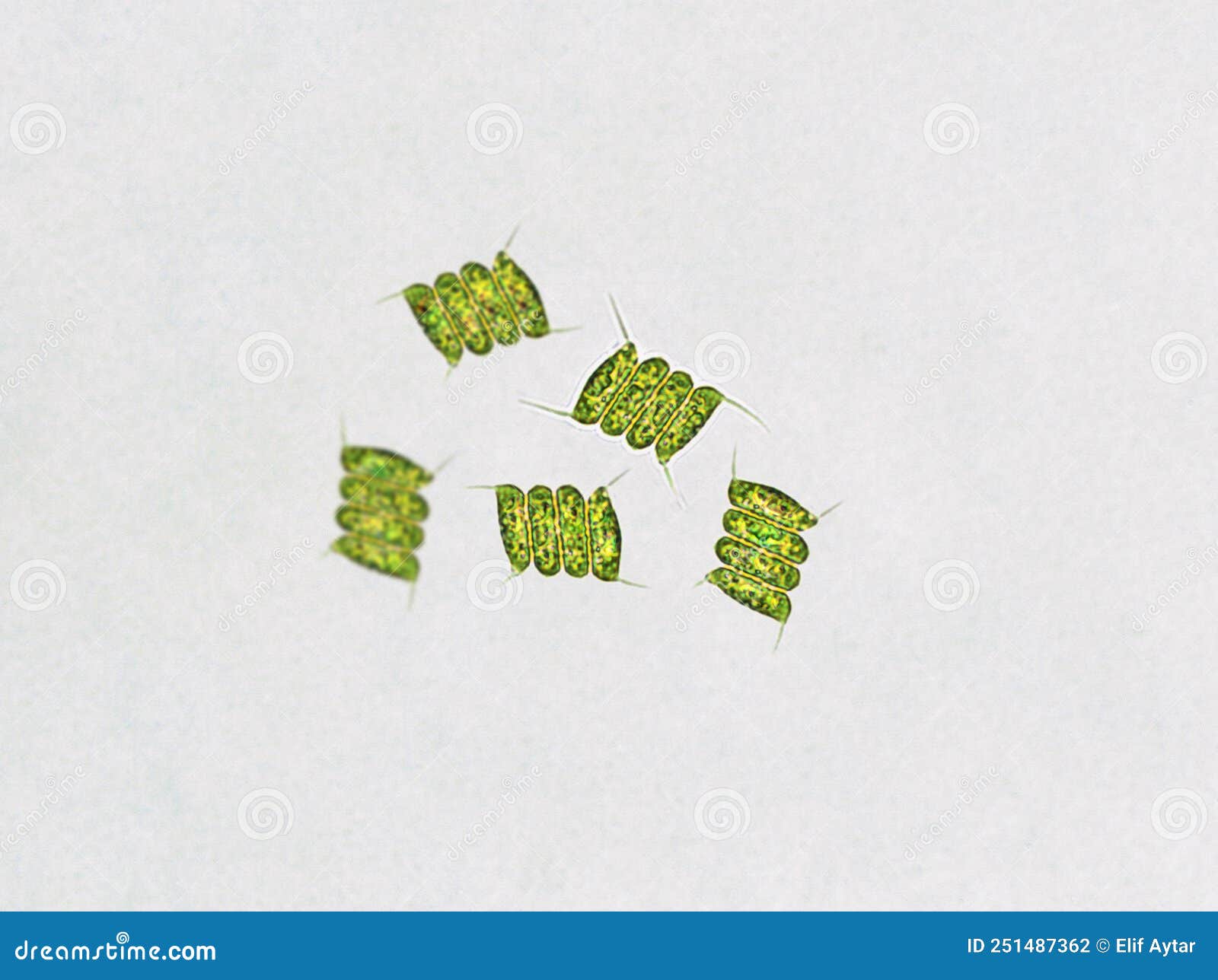 Scenedesmus Sp. Algae Under Microscopic View Stock Photo - Image of ...