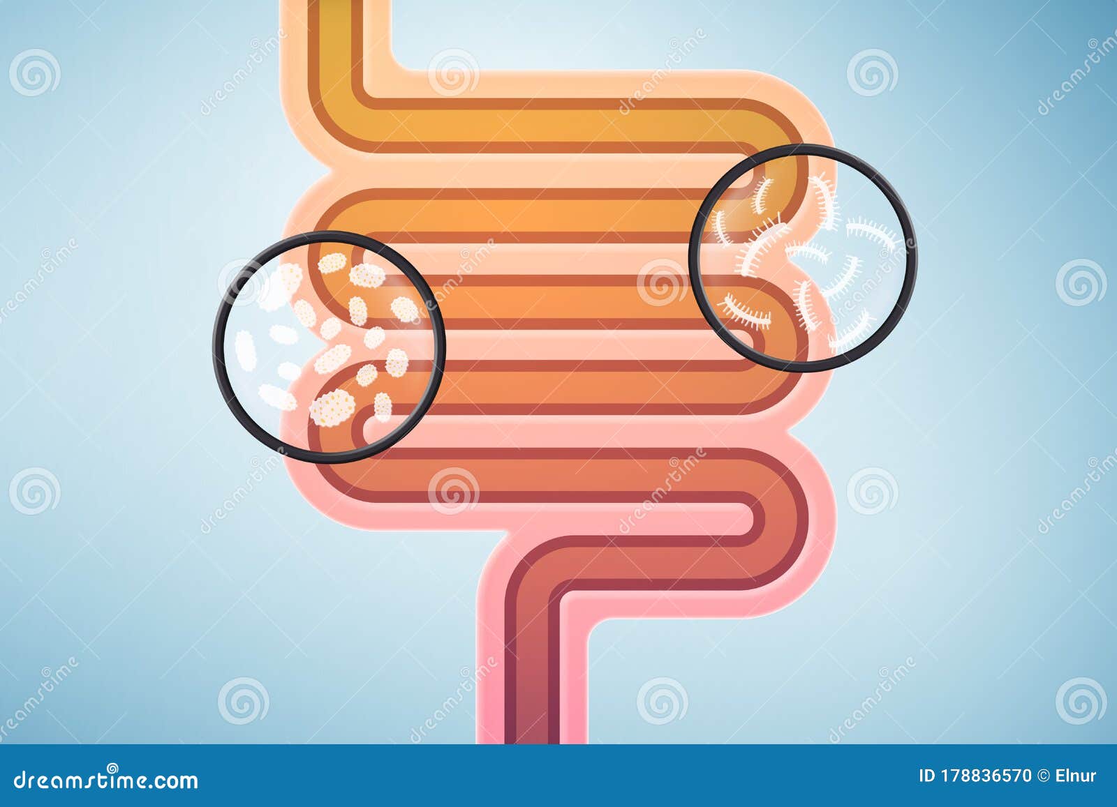 Human Intestines Green Background. Diarrhea And Constipation. Stitches ...