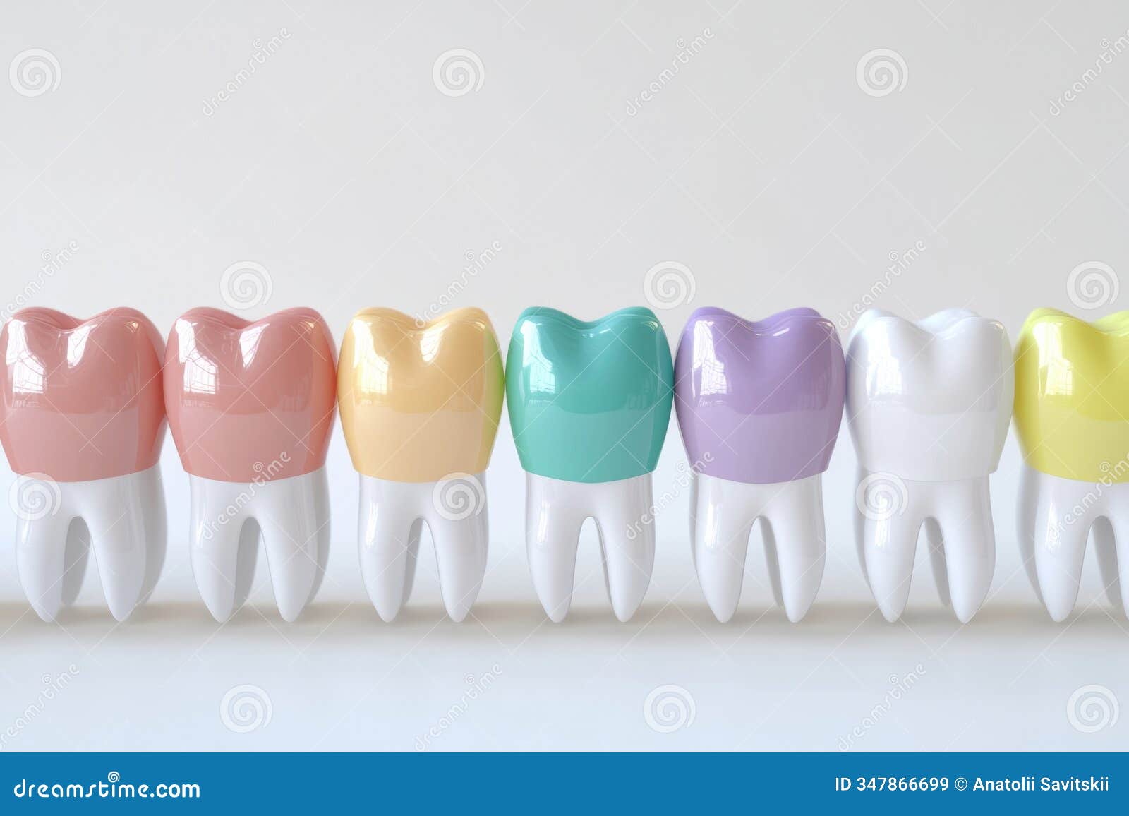 Schematic Illustration Showcasing a Series of Colored Dental Implants ...