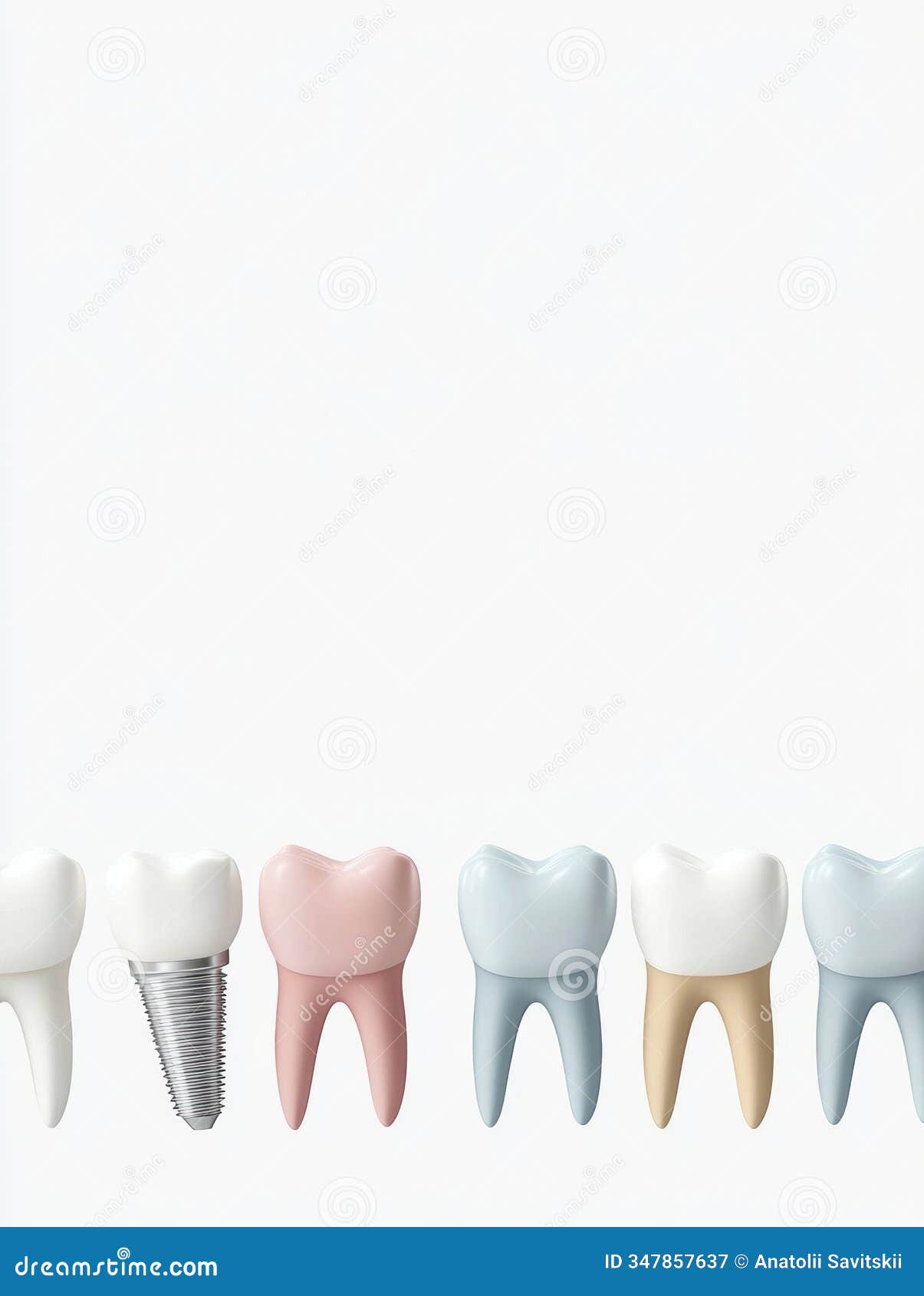 Schematic Representation Showing a Row of Teeth with Colored Dental ...