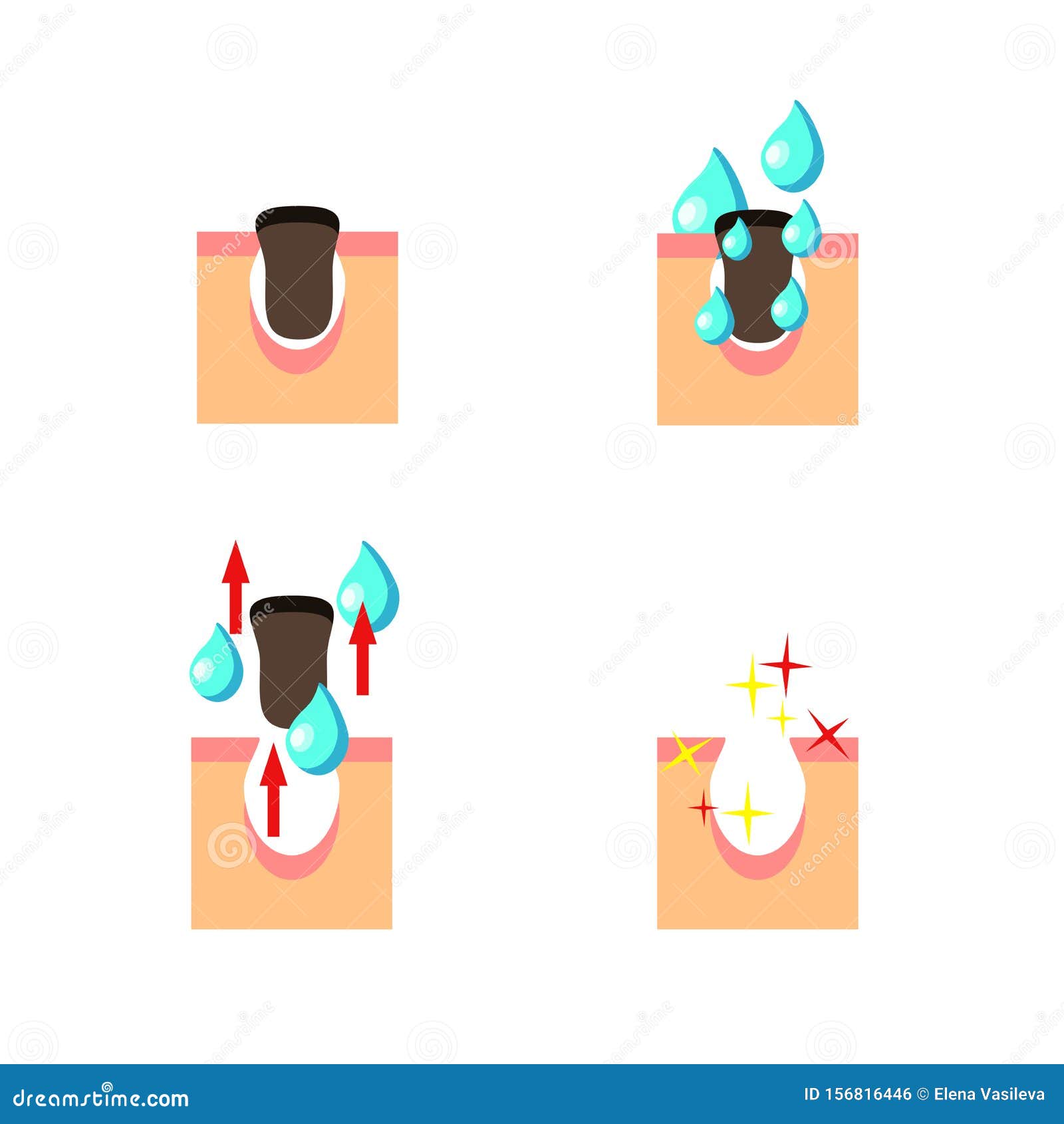 Cleansing Skin Process, Vector Illustration Isolated On The White ...