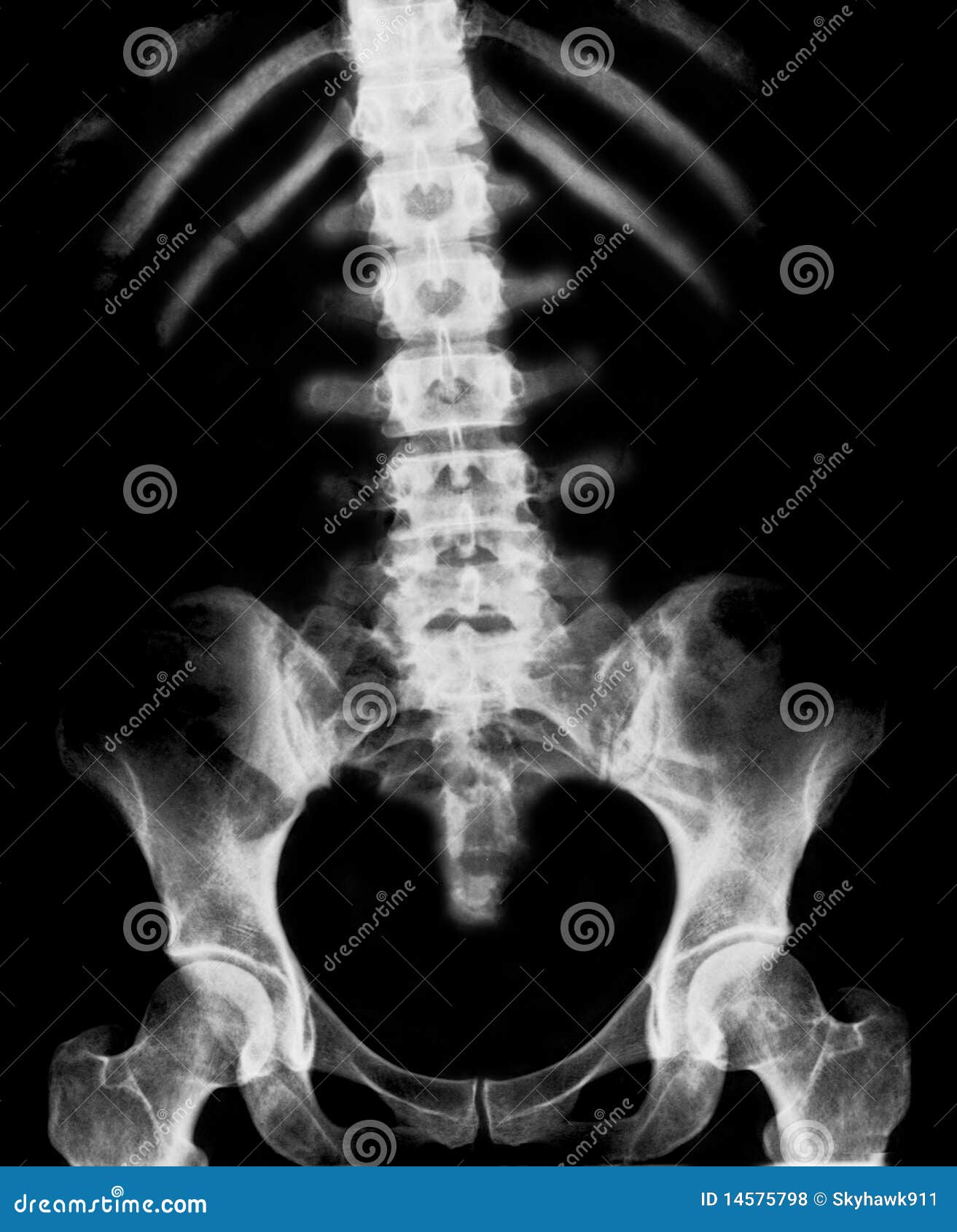 Spine Anatomy Scheme Photos - Free & Royalty-Free Stock Photos from ...