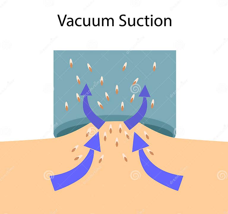Scheme of Vacuum Suction Process, Vector Illustration Stock Vector ...