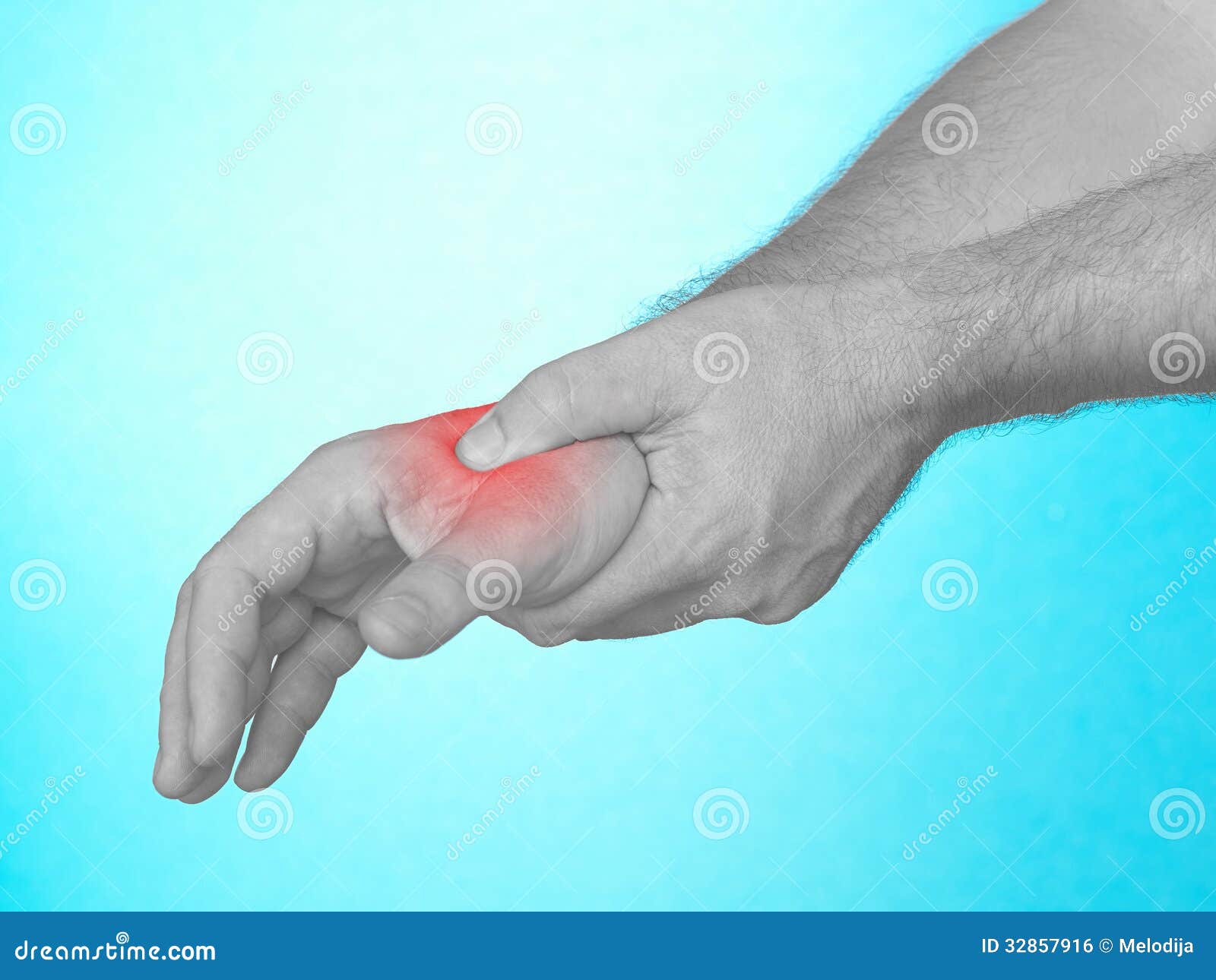 Scherpe Pijn in Palm Van Hand. Stock Foto - Image of lichaam ...