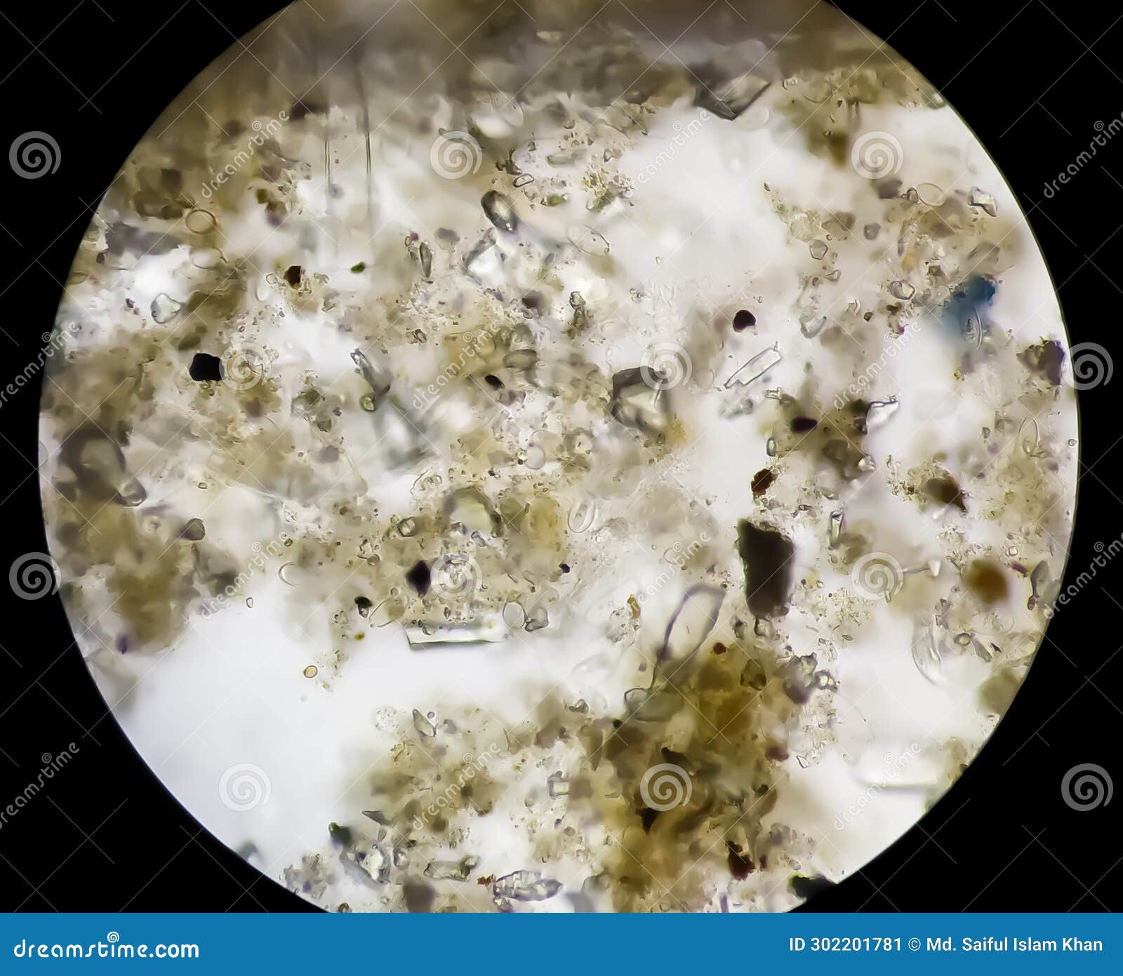 Schistosoma Parasite and Ova in Human Urine Specimen Under Microscope ...