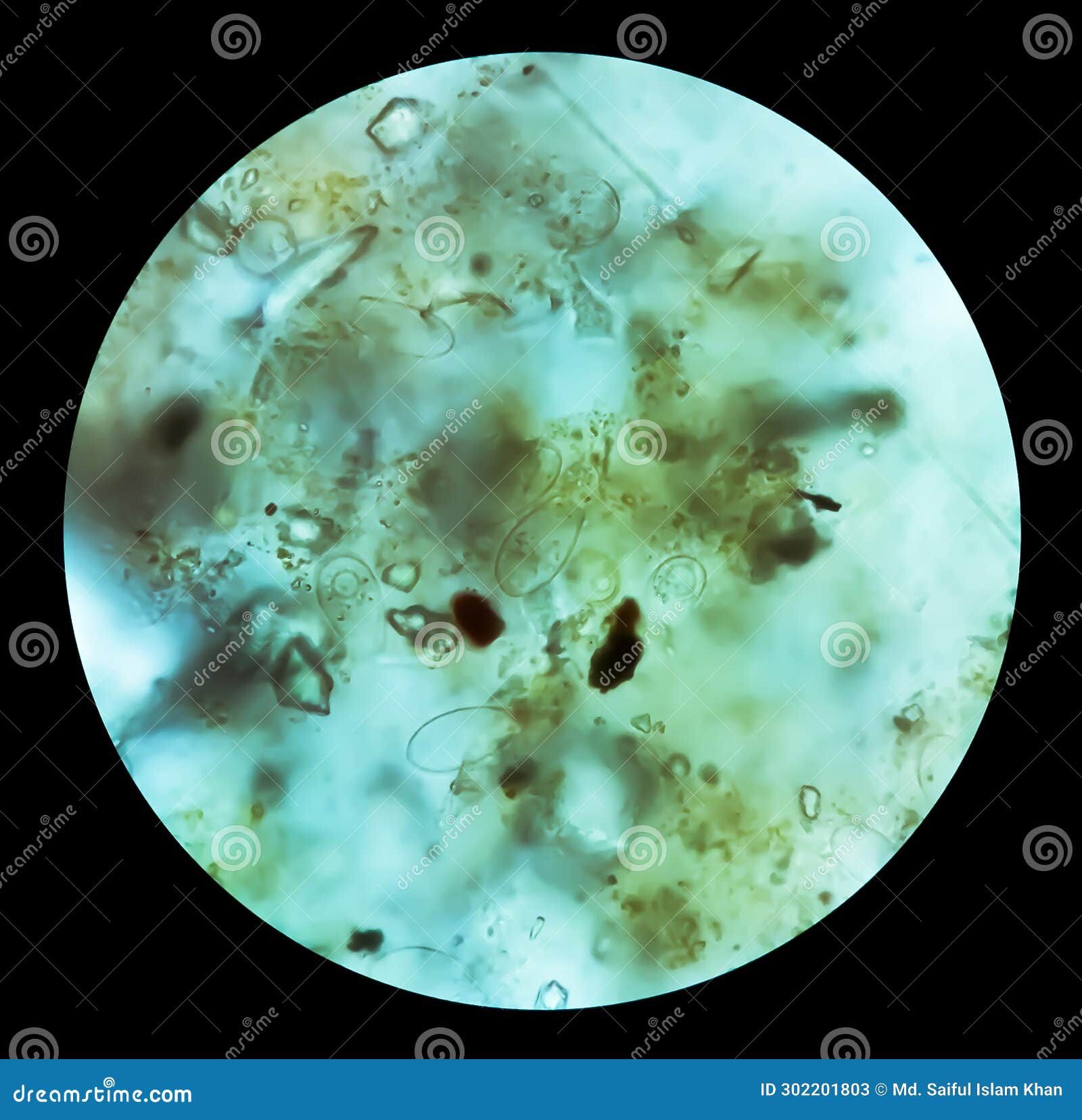 Schistosoma Mansoni Parasites Under The Microscope. Royalty-Free Stock ...