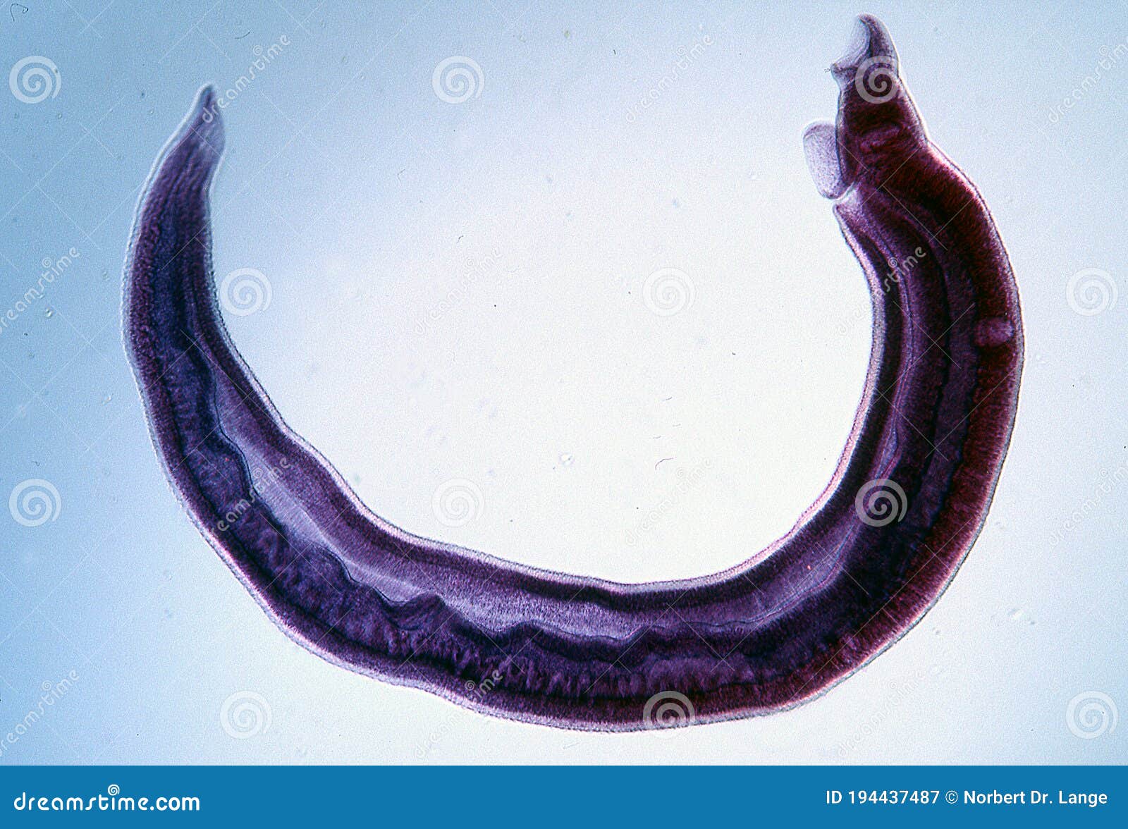 Schistosomiasis Leeches As a Parasite Stock Image - Image of couple ...