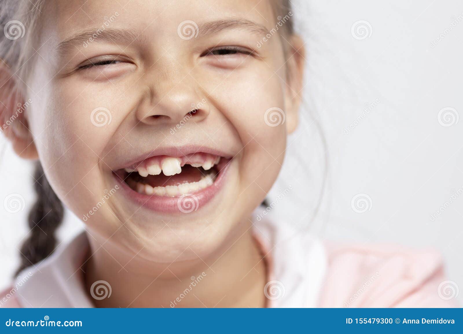 A School-age Girl without a Front Tooth is Laughing. Close-up Stock ...