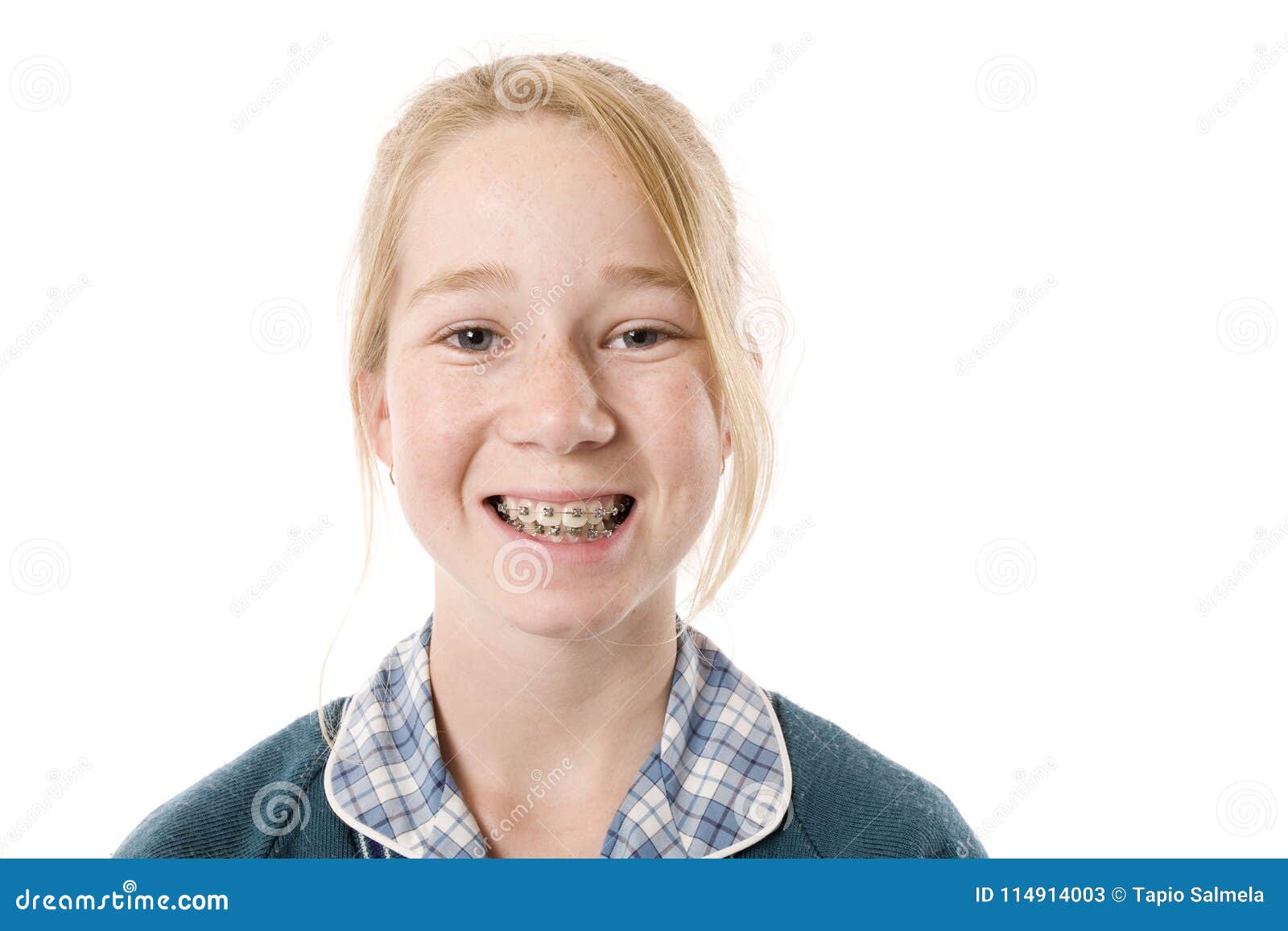 School Student Braces Smile. Stock Image - Image of student, camera ...