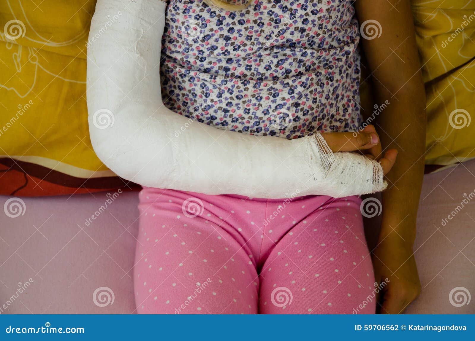Schulter im Verband stockfoto. Bild von person, gips - 59706562