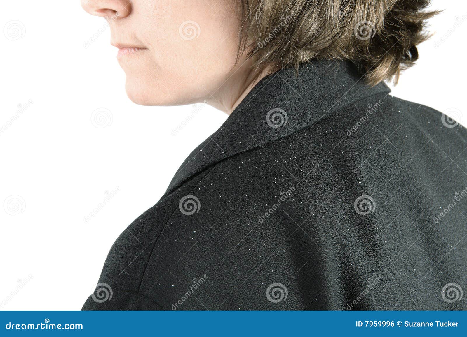 Schulter mit Schuppe stockfoto. Bild von schuppenflechte - 7959996