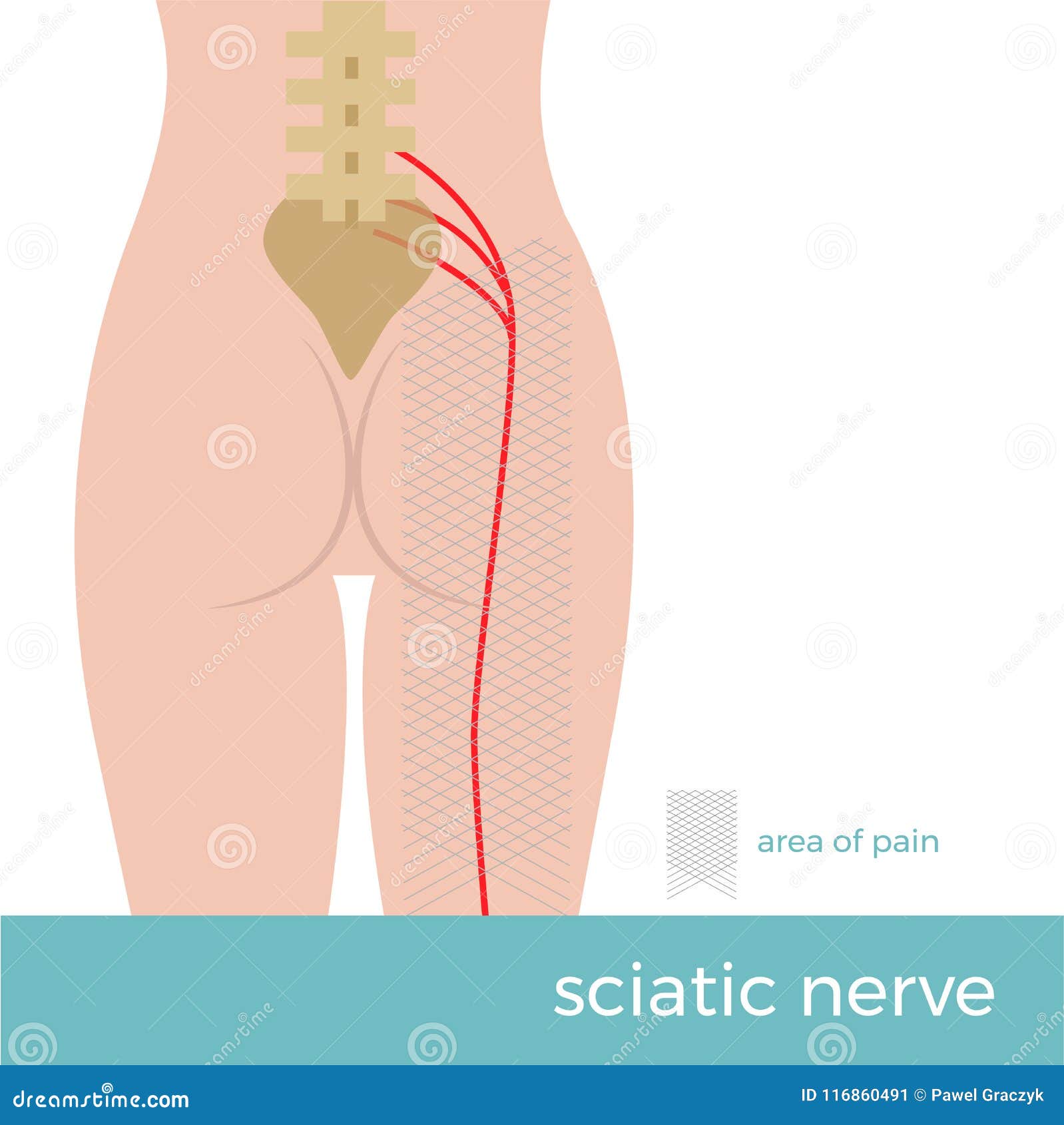 Sciatic Nerve Anatomy Vector Format Illustration | CartoonDealer.com ... Sciatic Nerve Anatomy Vector Format Illustration | CartoonDealer.com ...
