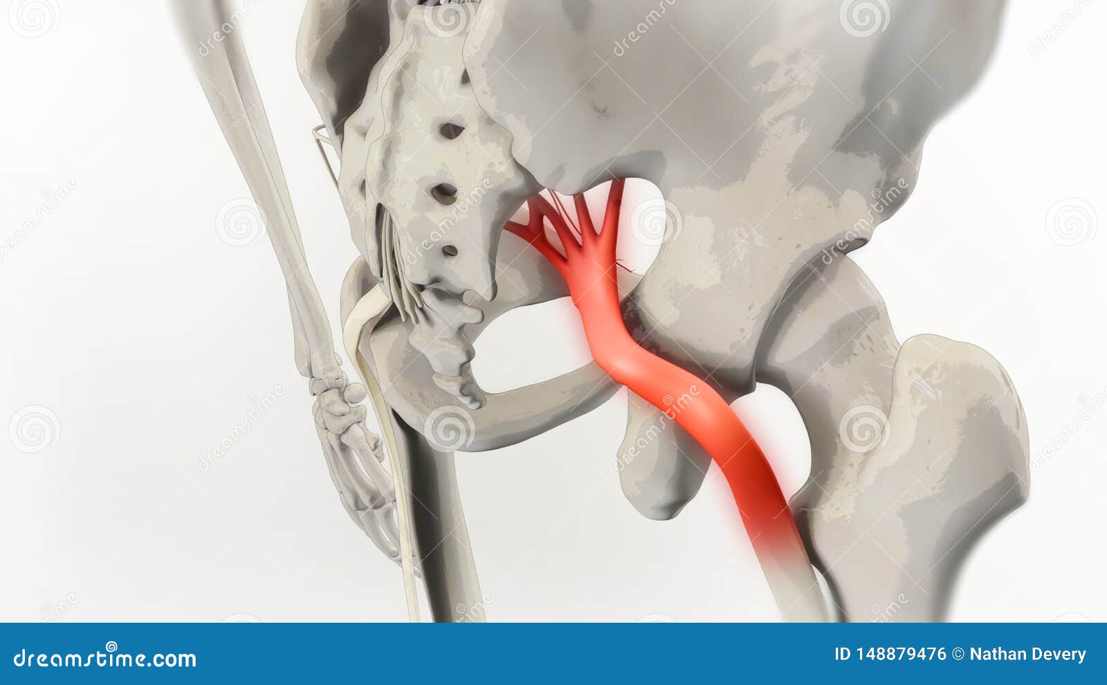 Sciatic Cartoons, Illustrations & Vector Stock Images - 532 Pictures to ...