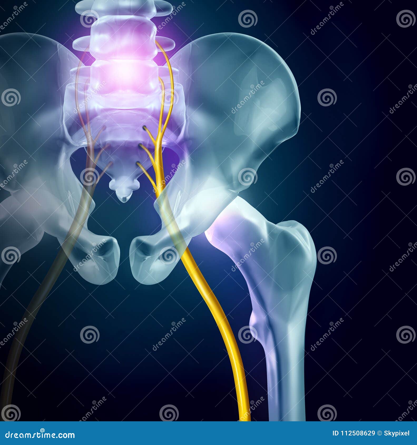 Sciatica Pain Concept stock illustration. Illustration of concept ...