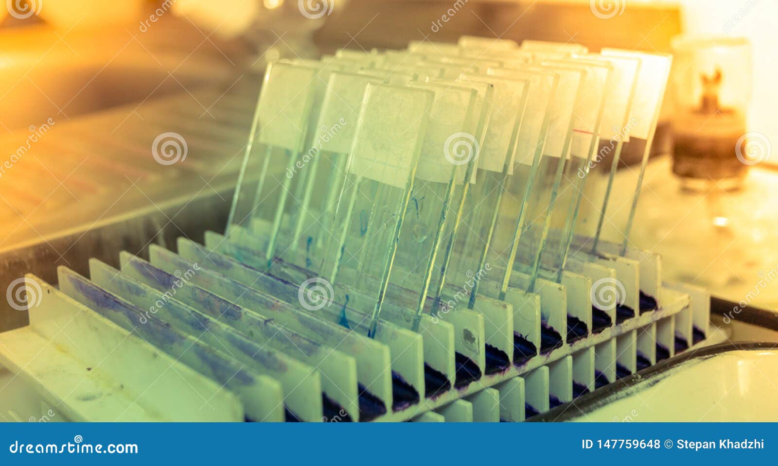 Science Medical Glass Microscope Slide with Sample Stock Photo - Image ...