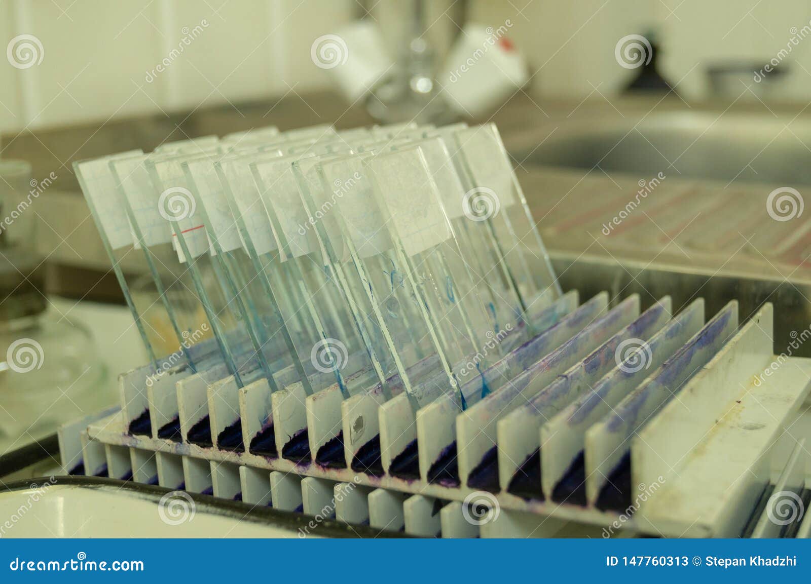 Science Medical Glass Microscope Slide with Sample Stock Image - Image ...