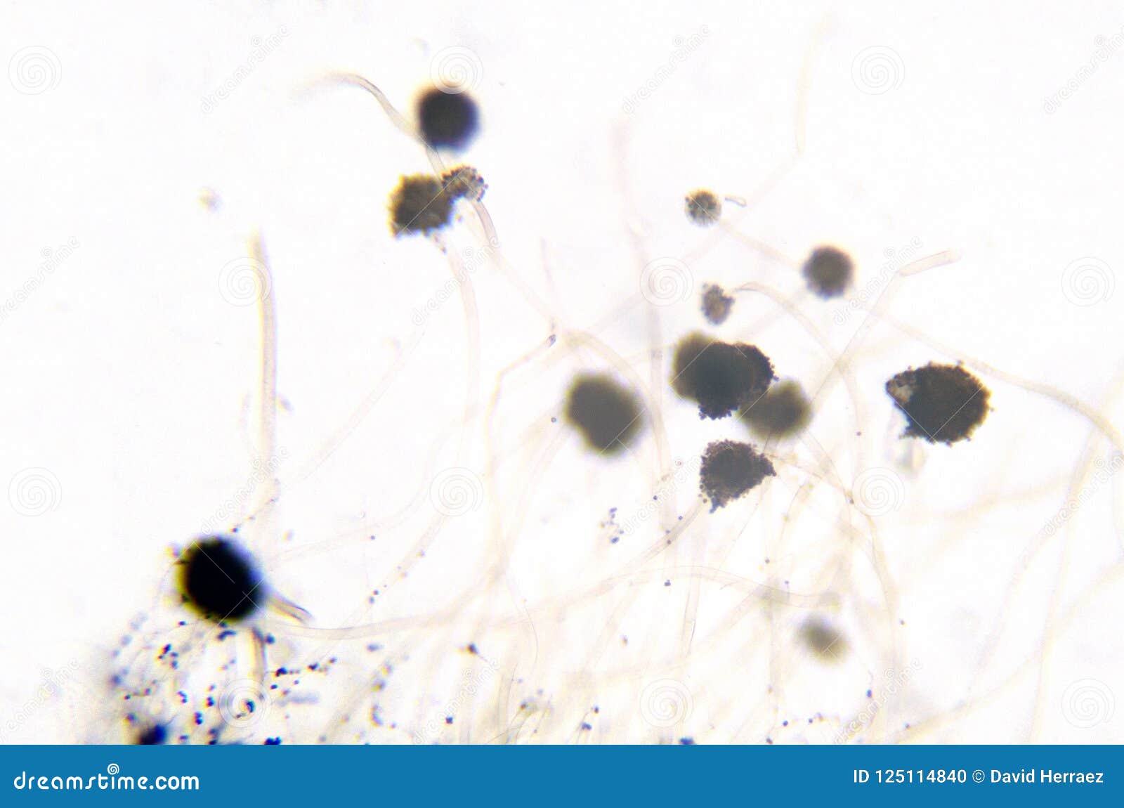 Microscope Photography of Aspergillus Stock Photo - Image of micro ...