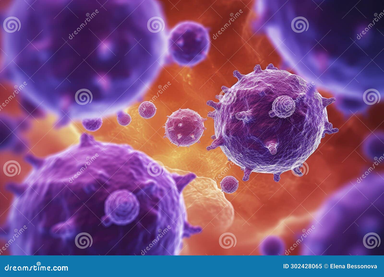 Dendritic Cells (DC) Recognize Acute Myeloid Leukemia (AML) - Isometric ...