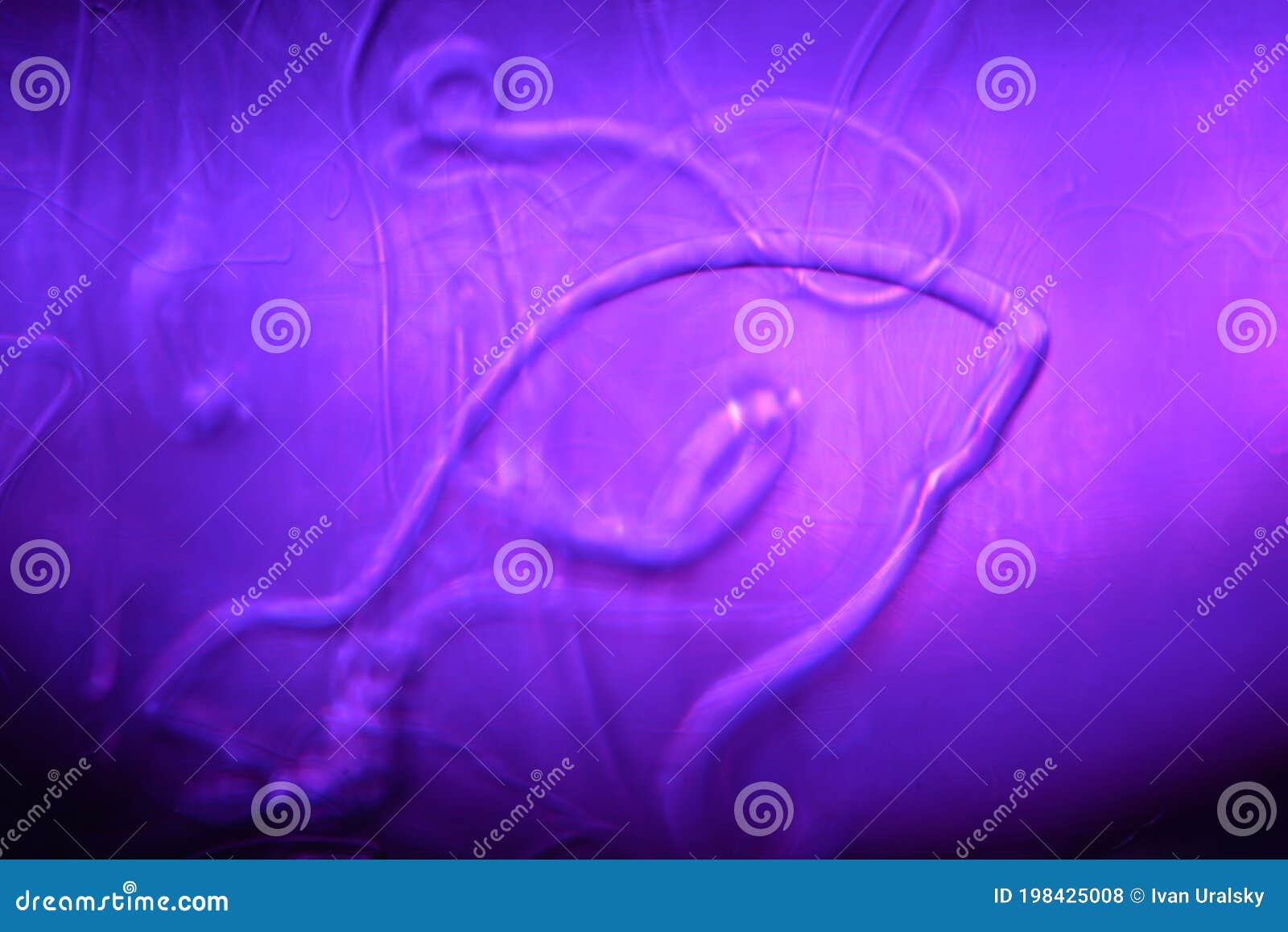 Scientific Photograph of Parasites in Human Blood Plasma Under a ...