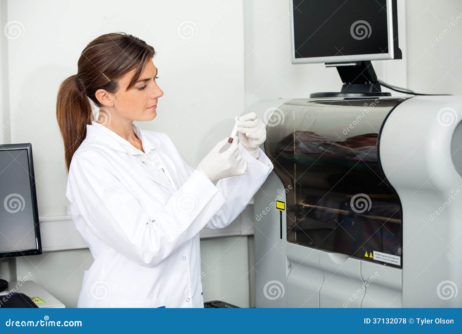 Scientist Analyzing Blood Sample for Coagulation Stock Photo - Image of ...