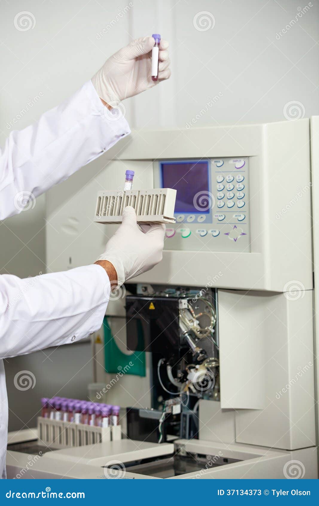 Scientist Analyzing Blood Sample in Laboratory Stock Image - Image of ...