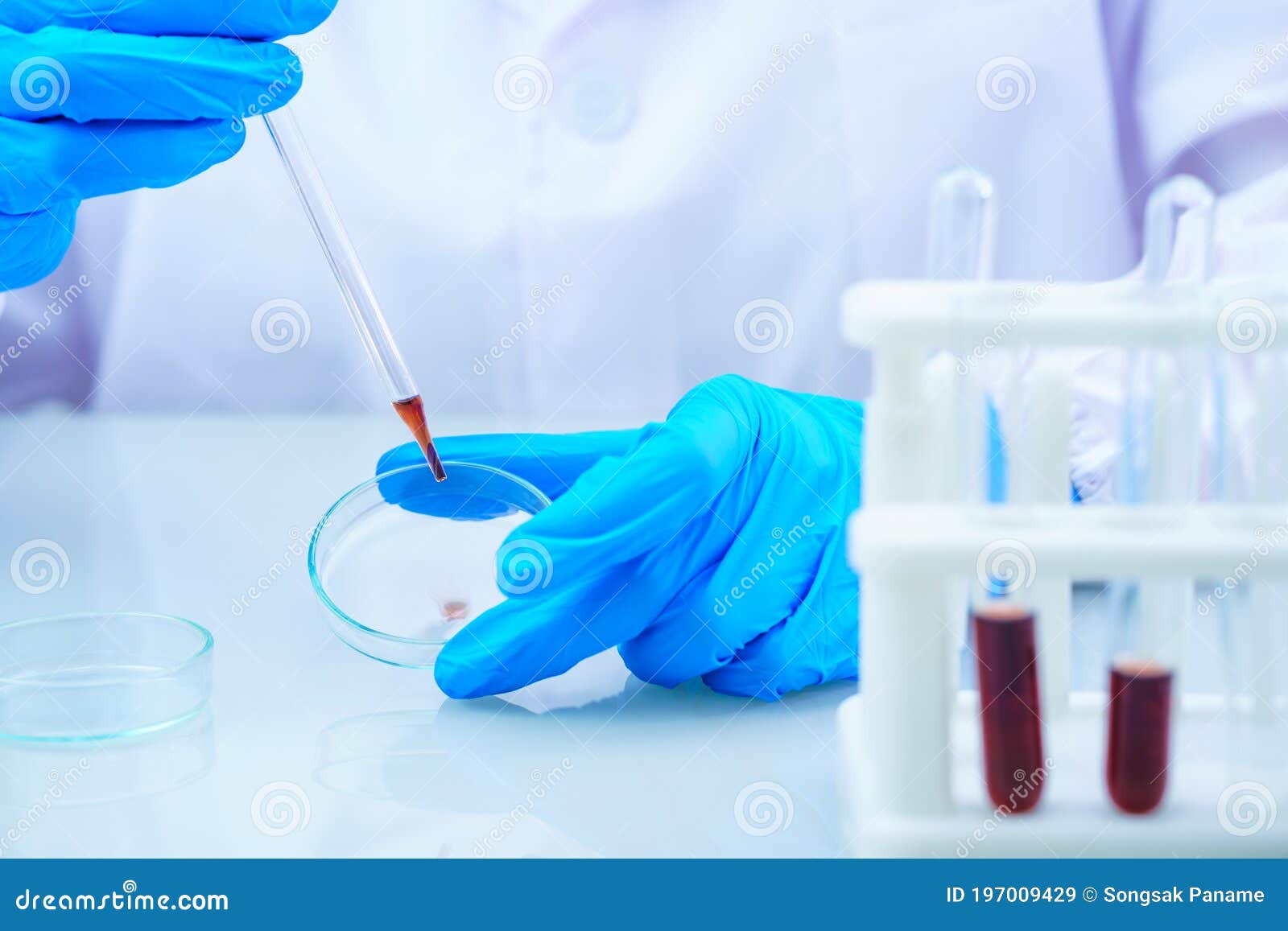 Scientist Analyzing a Blood Sample on Tray in Laboratory Stock Image ...