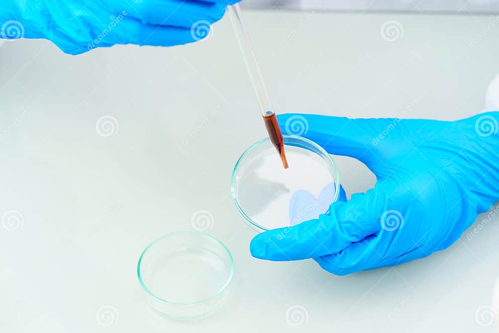 Scientist Analyzing a Blood Sample on Tray in Laboratory Stock Photo ...