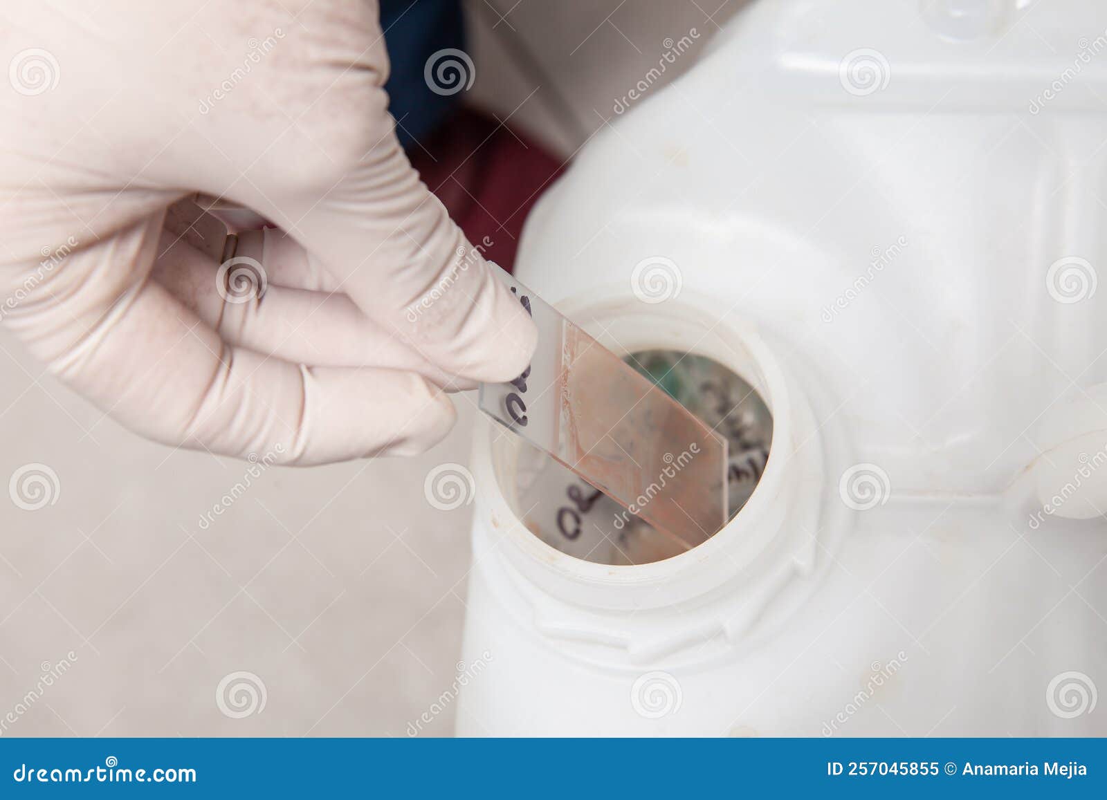 Scientist Discarding a Microscope Glass Slide with a Blood Smear Stock ...
