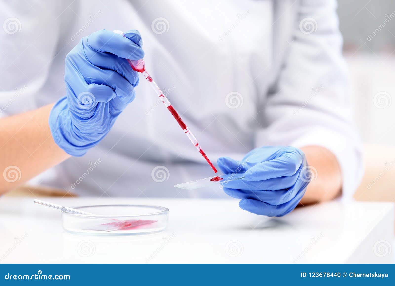 Scientist Dripping Blood Sample on Glass Stock Photo - Image of ...