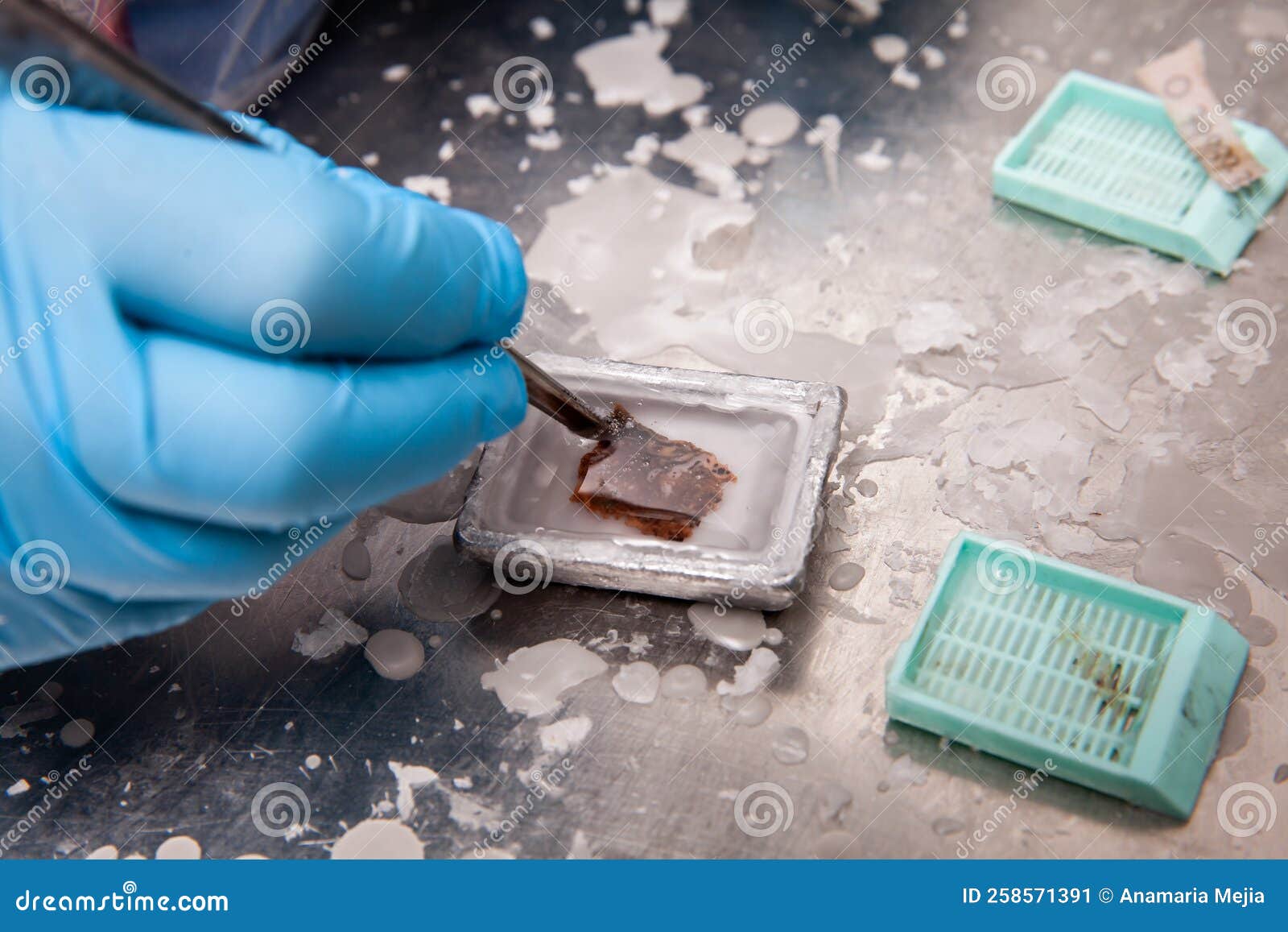 Scientist Embedding Tissues In Paraffin Blocks For Sectioning