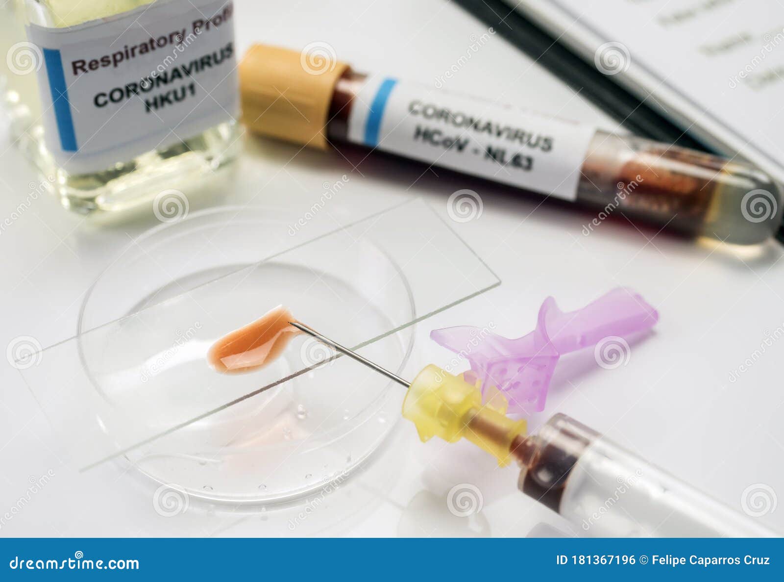 Scientist Examines Blood Sample from Sars-Cov-2 Infected Patient in ...