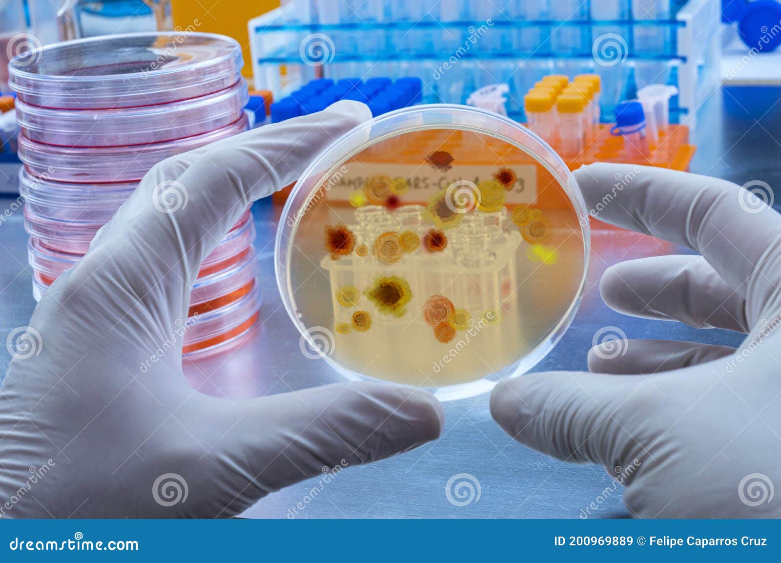 Scientist Examines Malaria Virus on Petri Dish in Laboratory Stock ...