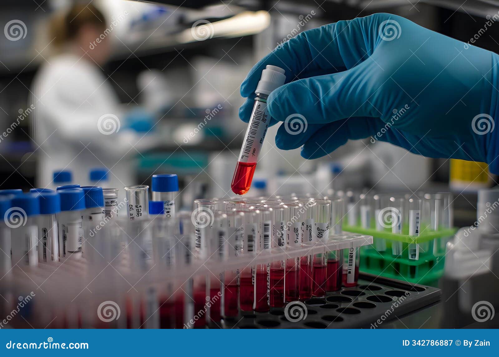 Scientist Handling Blood Samples in Laboratory for Medical Research ...