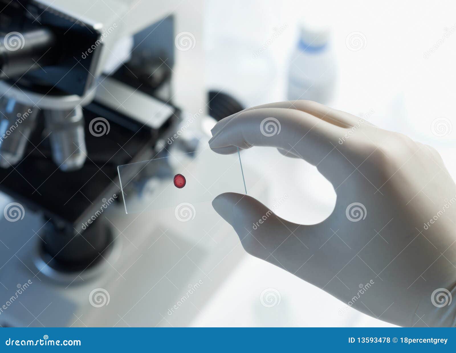 Scientist Holding Blood Sample Slide Stock Photo - Image of scientific ...