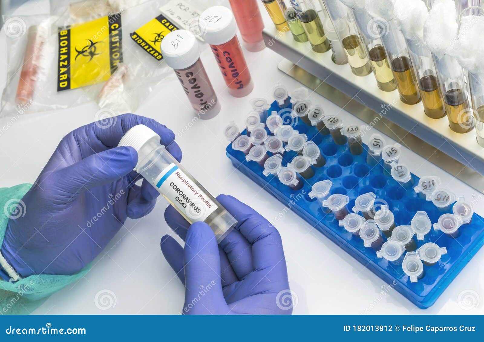 Scientist Holds Vial with Sample of Coronavirus OC43 in a Specialized ...