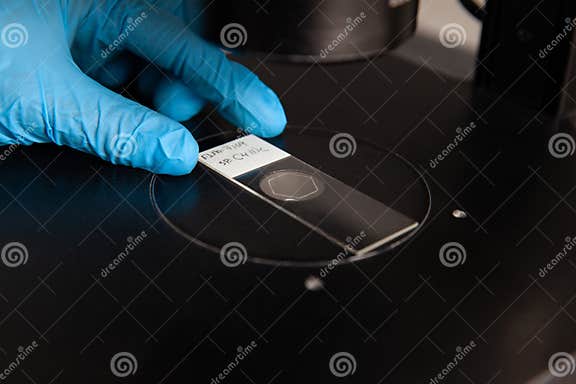 Scientist Looking at Slides with Patient Samples Using an Inverted ...