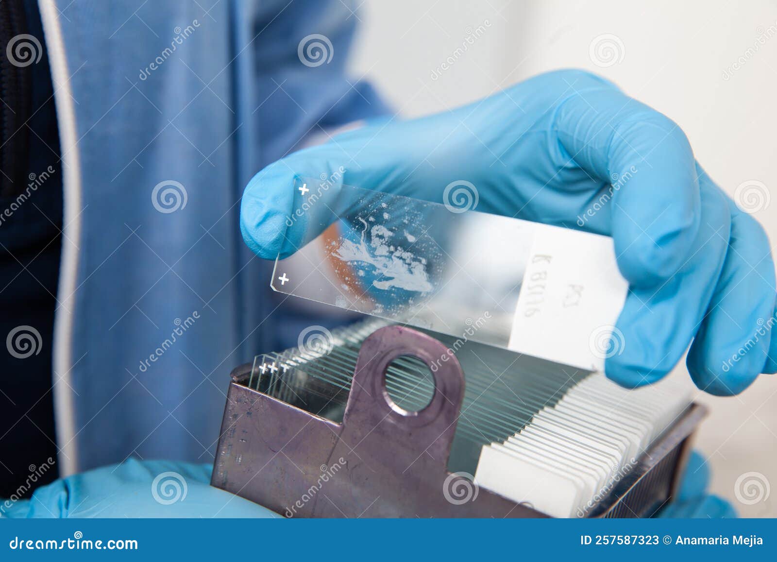 Histology Paraffin Embedded Tissue Samples Into A Slide Stock Photo ...