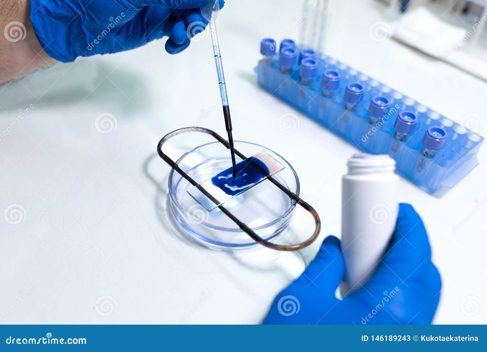 Scientist Prepare Blood Sample for Research on Microscope. Placing ...