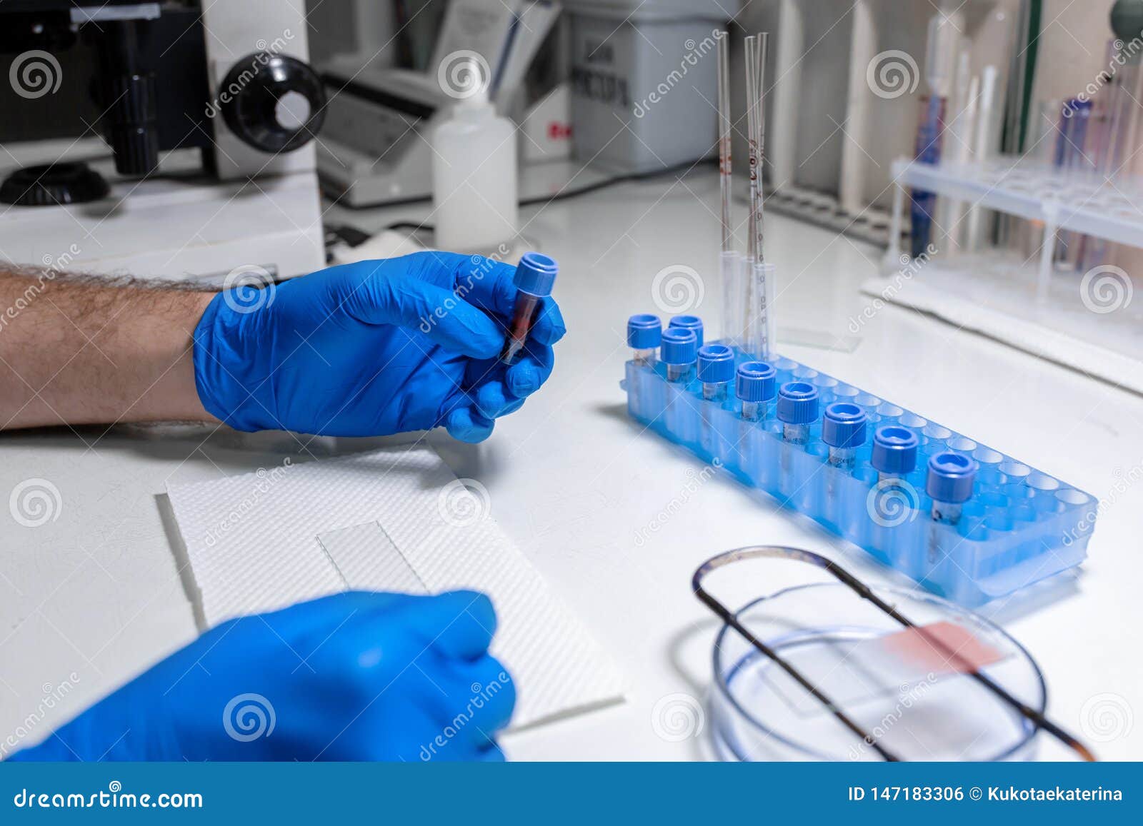 Scientist Prepare Blood Sample for Research on Microscope. Placing ...