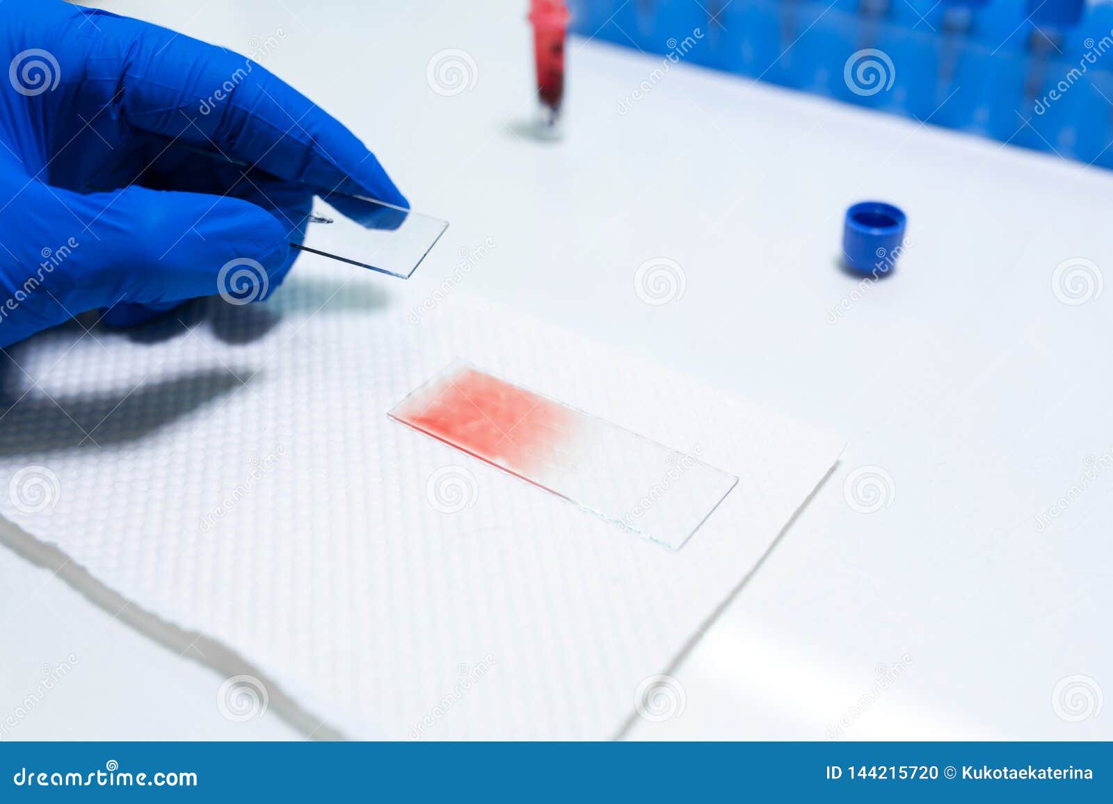 Scientist Prepare Blood Sample for Research on Microscope. Placing ...