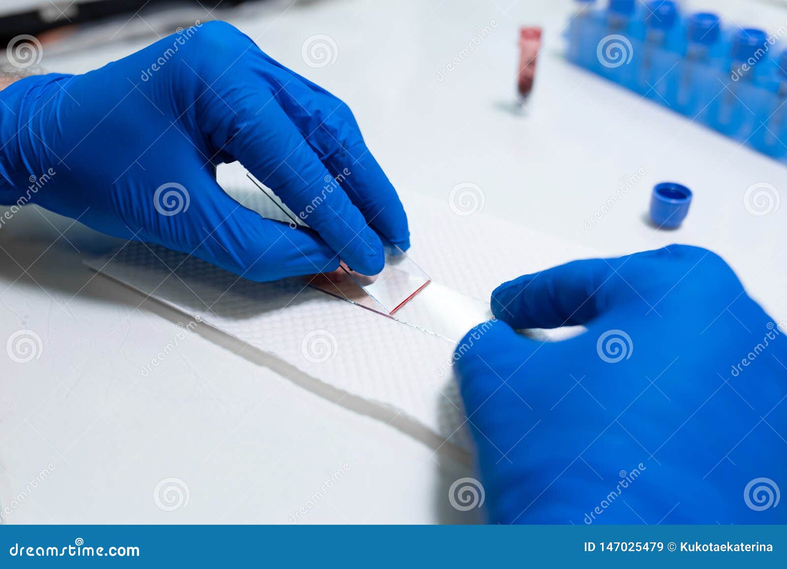 Scientist Prepare Blood Sample for Research on Microscope. Placing ...