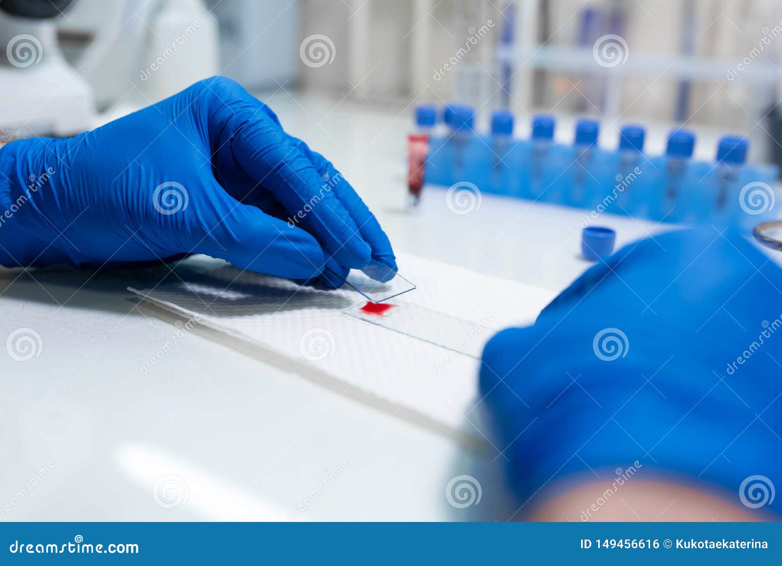 Scientist Prepare Blood Sample for Research on Microscope. Placing ...